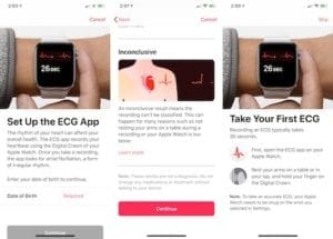 How to use the ECG App on Apple Watch - AppleToolBox